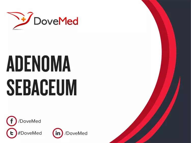 Adenoma Sebaceum - DoveMed