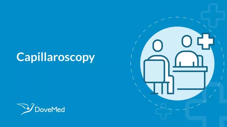 Capillaroscopy - DoveMed