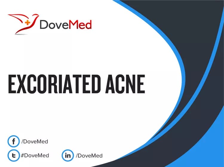 Excoriated Acne - DoveMed