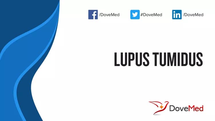 Lupus Tumidus - DoveMed