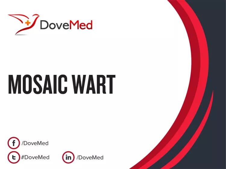 Mosaic Wart - DoveMed