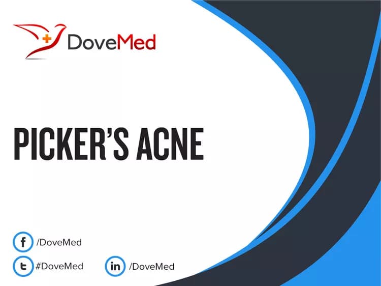 Picker’s Acne - DoveMed