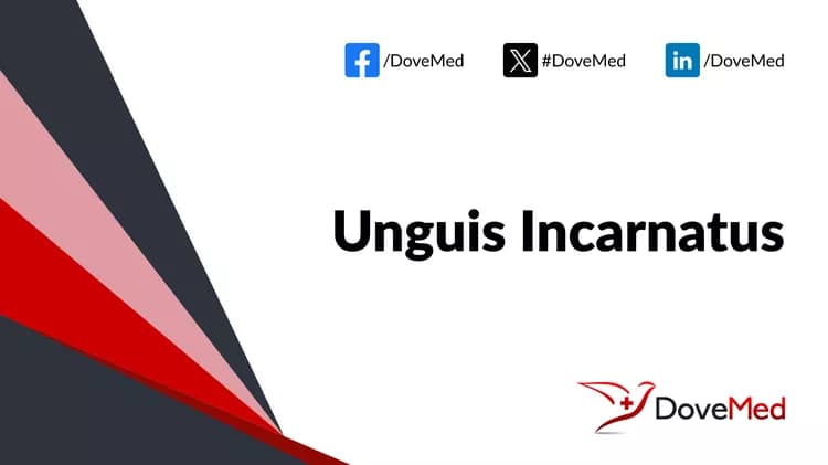Unguis Incarnatus - DoveMed