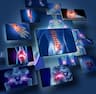 Chromosome 3q Duplication Syndrome - DoveMed